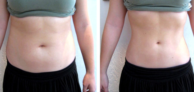 Body Toning System: Achieve Your Ideal Shape | The Body Firm